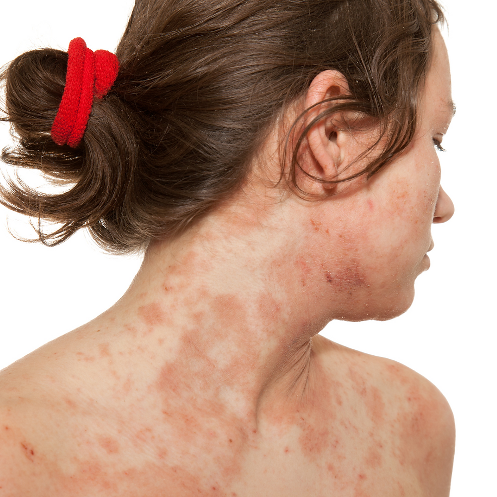 26 Tips for Skin Picking: A to Z