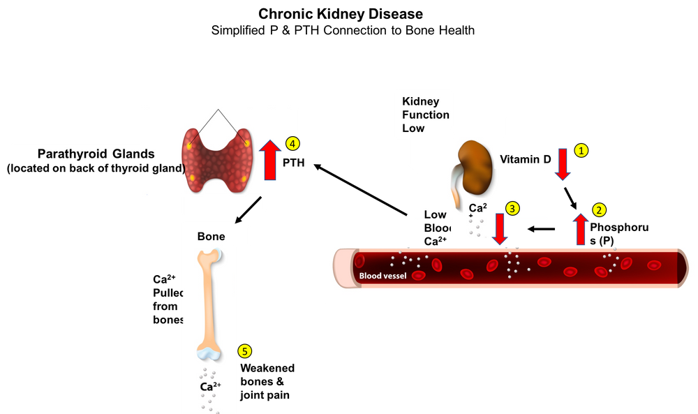 The 2 P’s: P & PTH. What do they stand for and why are they important?
