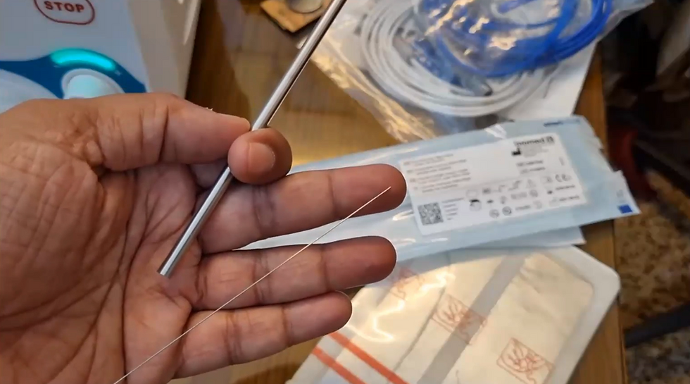 Radio Frequency (RF) in Pain Management