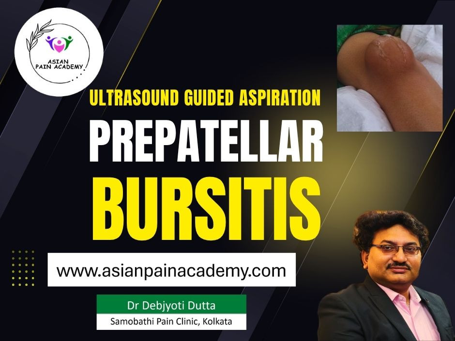 Prepatellar Bursitis Under Ultrasound – A Live Demo by Dr. Debjyoti Dutta
