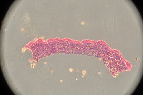 CAP Skin | hoftherapeutics.com