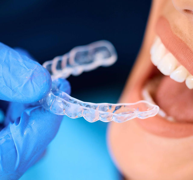 invisalign teesside