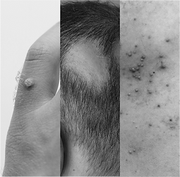 First-in-Class Dermatology Drugs | Veradermics