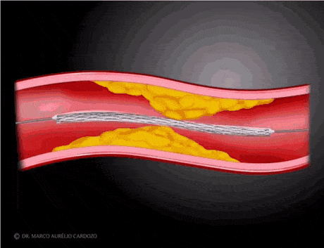 PESQUISA ANALISA OS BENEFÍCIOS DO VINHO PARA O CORAÇÃO E PARA A MENTE