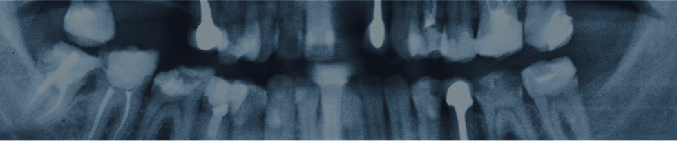 Biotem Implant System | INNODENT | Dental supplies l Melbourne VIC