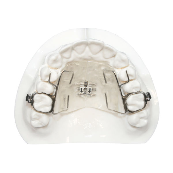 Orthodontic Expansion