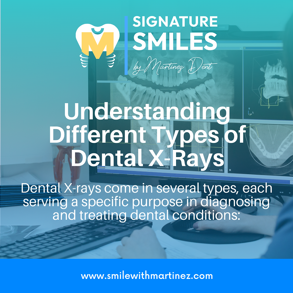 Understanding Different Types of Dental X-Rays