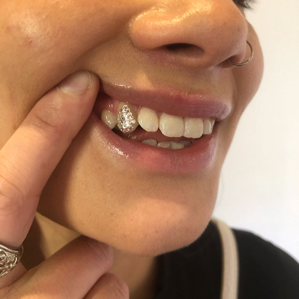 Tooth Gems | Dazzle Teeth | Christchurch New Zealand