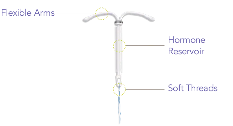 What the Kyleena is and why consider it