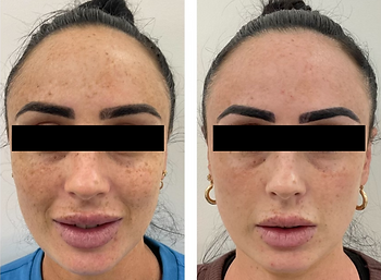 VENUSIA | Aesthetic Medical Clinic | DR ROD PARNIAN