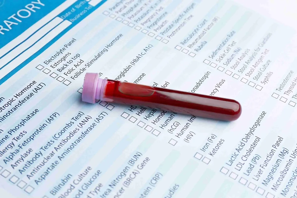 Understanding your Blood Test