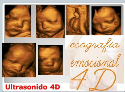 Ultrasonido 4D | Eco 4D Lab