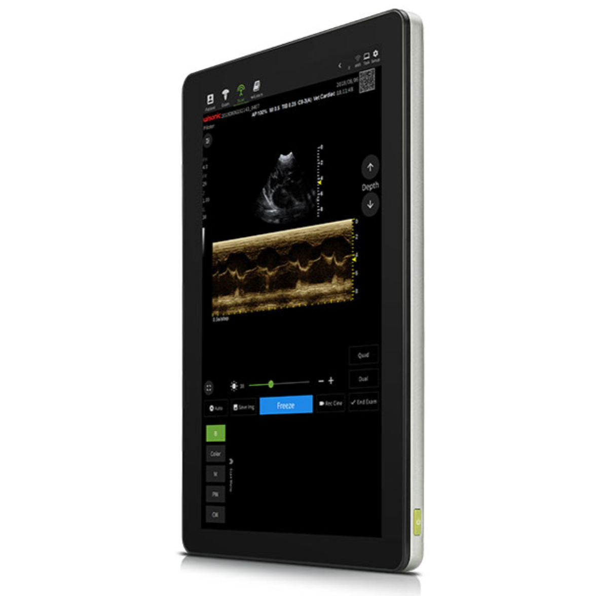 Piloter Ultrasound | Wisonic | Vet Trade