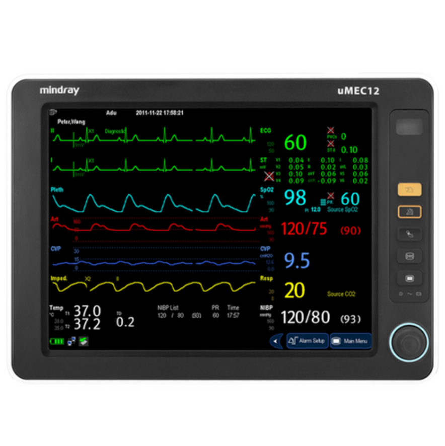 Mindray uMEC12 Vet Monitor incl. CO2 | Vet Trade