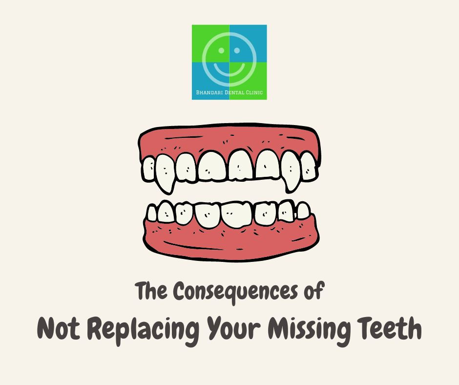 The Consequences Of Not Replacing Your Missing Teeth