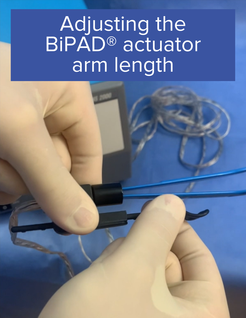 Adjusting the BiPAD® Actuator Arm Length