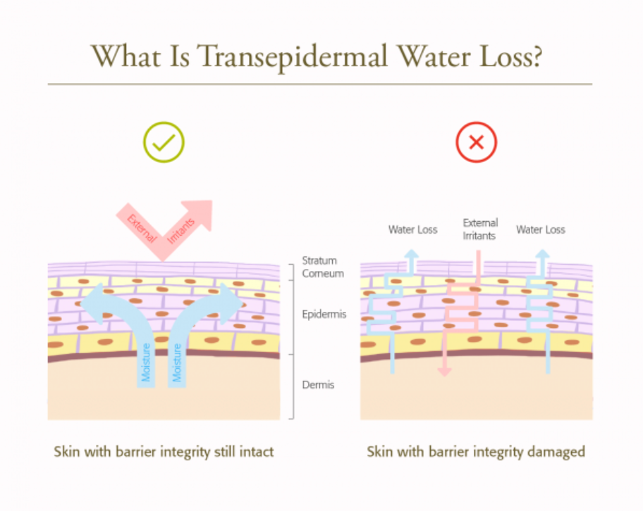 What Is Transepidermal Water Loss And How To Prevent It.