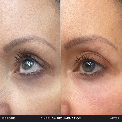 Results Gallery | Ameela Skin