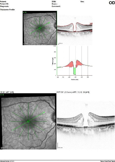 Combined confocal scanning laser ophthalmoscope (cSLO) - spectral ...