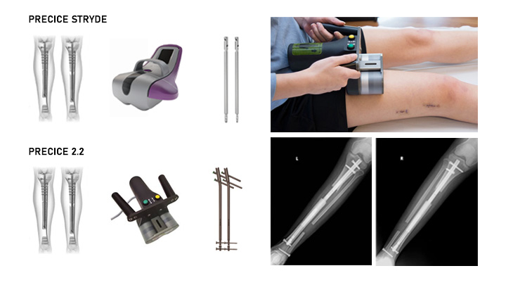 Height Increase Solution