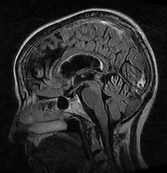 Lakeside MRI & Diagnostic Health | Services