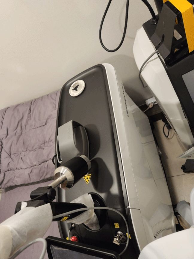 LASEROPTEK PicoLO | rescience