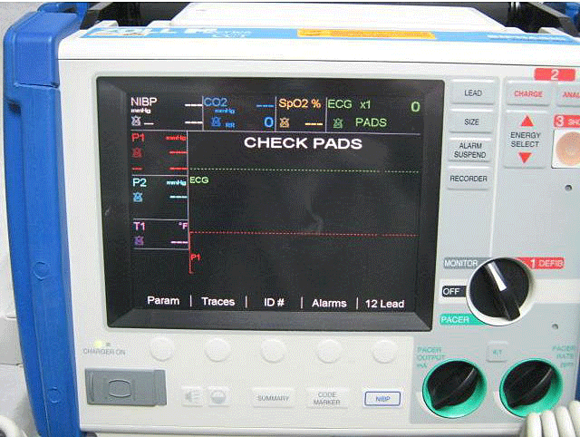 ZOLL M Series CCT DEFIBRILLATOR | rescience