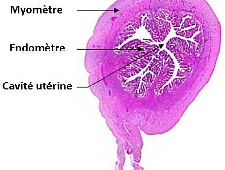 Réalisons un schéma de l'observation