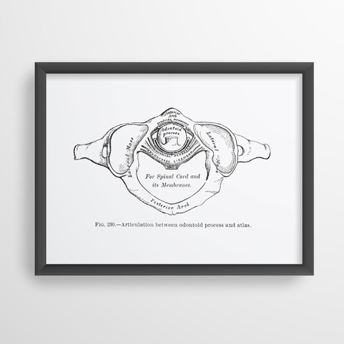 Articulation Odontoid Process Atlas Cervical Vertebra Spine Anatomy Art ...