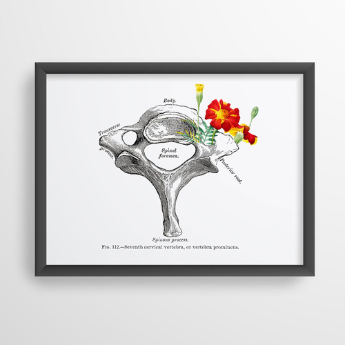 Vertebra Prominens Cervical Spine Bone Osteology Floral Anatomy Art ...