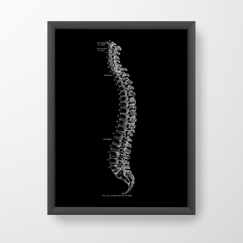 Lateral Spine Vertebrae Chiro Spinal Surgery Human Anatomy Art Print X ...