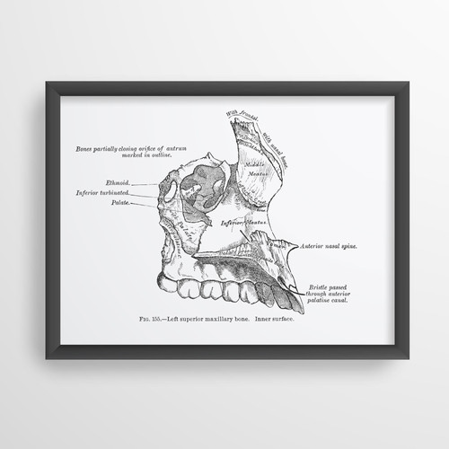 Maxillary Bone Dental Orthodontic Maxillofacial Oral Surgery Anatomy ...