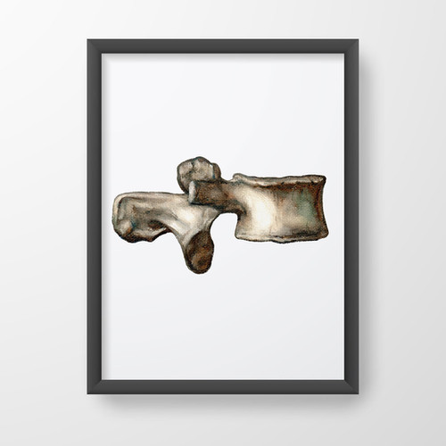 Lumbar Vertebra Spine Bone Vintage Osteology Painting Human Anatomy Art ...