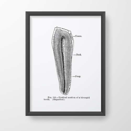 Bicuspid Tooth Structure Dental Oral Surgery Human Anatomy Vintage Art ...