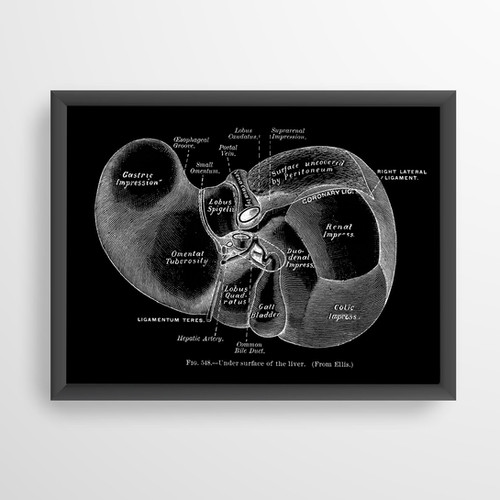 Liver Upper Surface Hepatology Internal Human Anatomy Art Print X-Ray ...