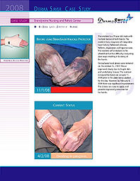 DermaSaver Case Studies | HealthSaver