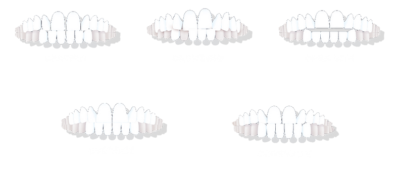Home | Shafaf Clear Aligners