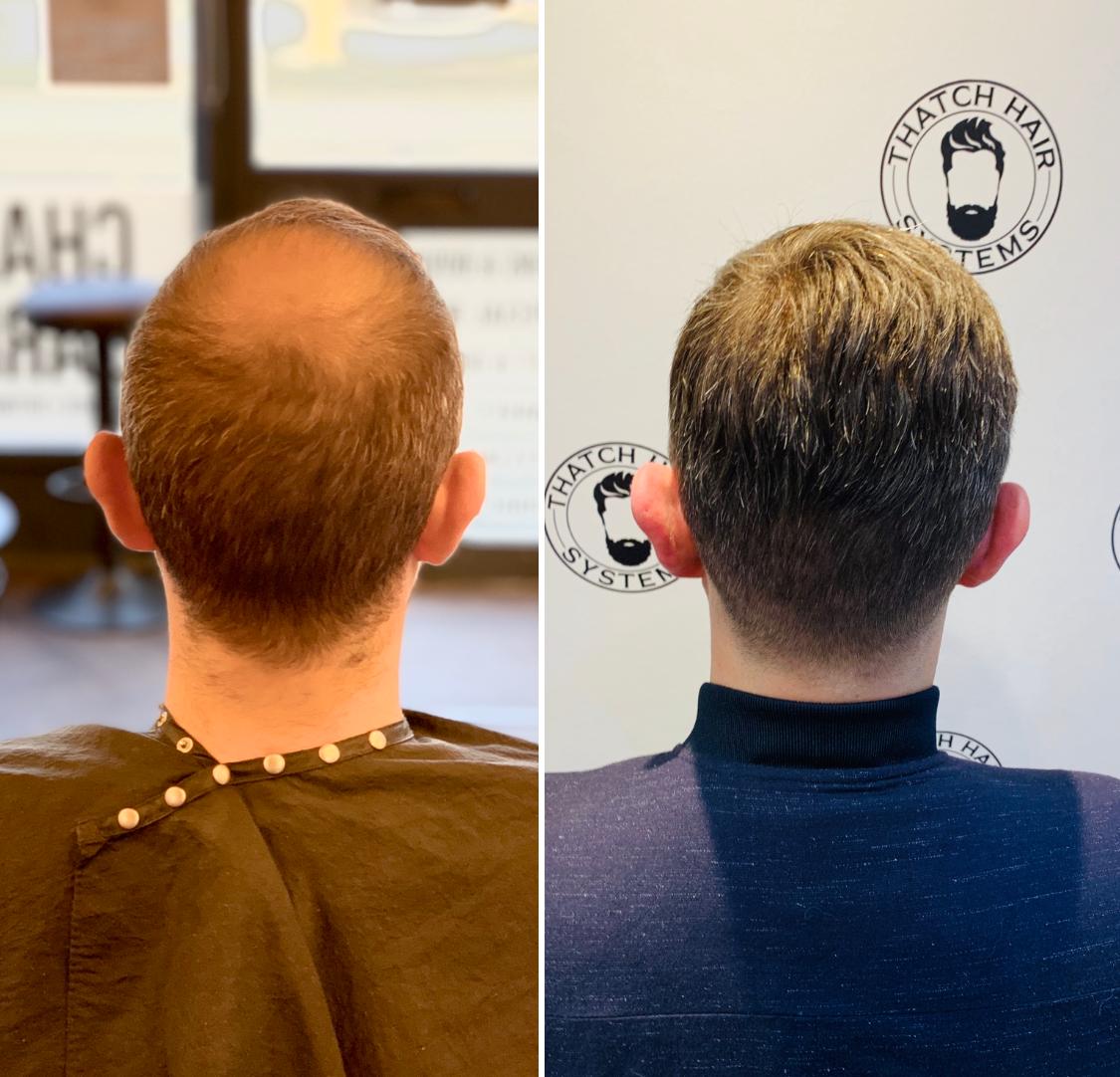 HOME | Thatch Hair Systems