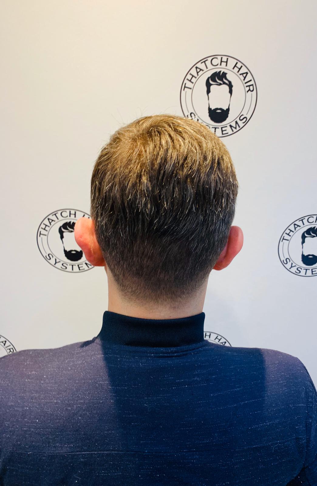 HOME | Thatch Hair Systems