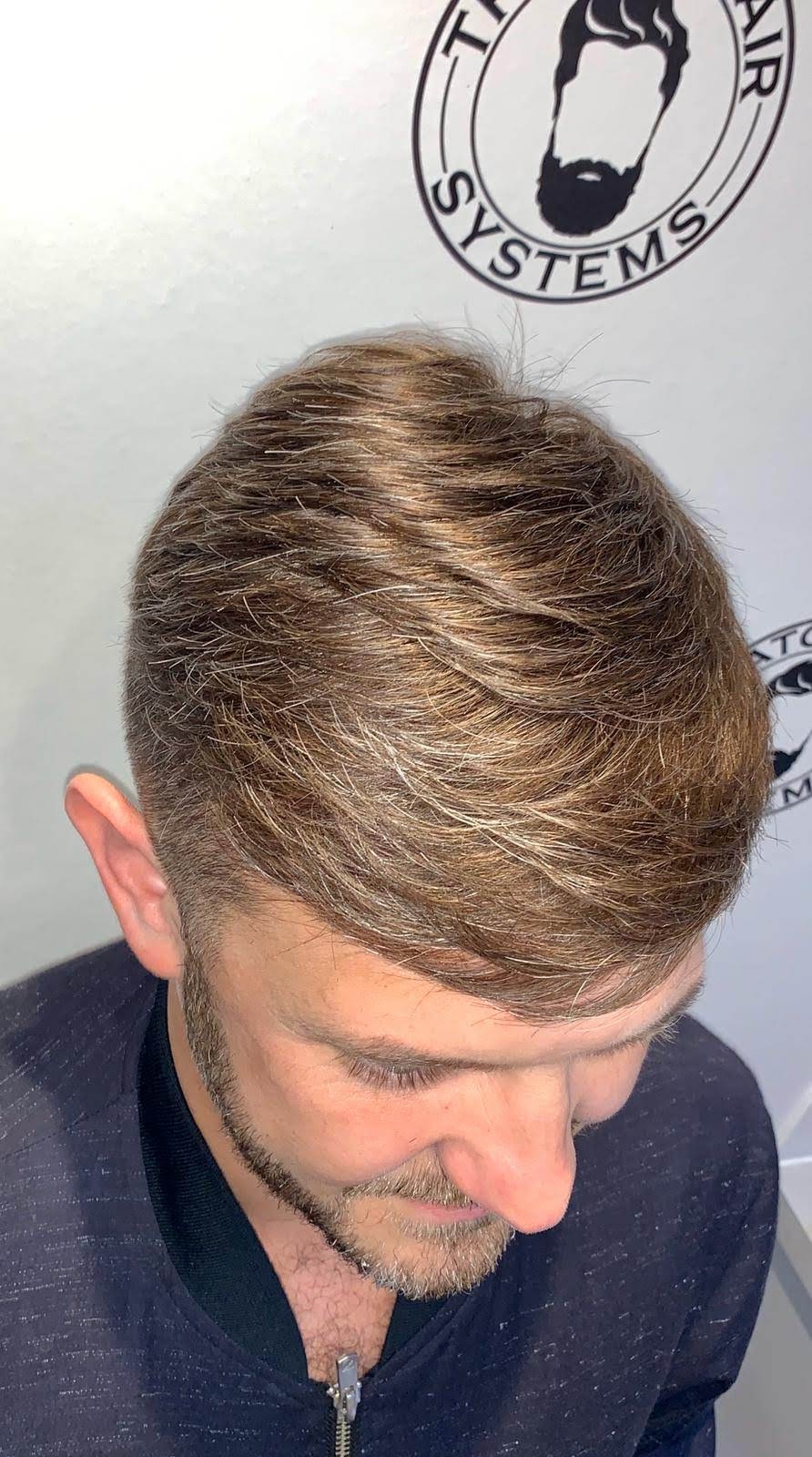 HOME | Thatch Hair Systems