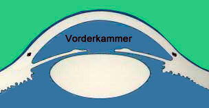Vorderkammer | oculus