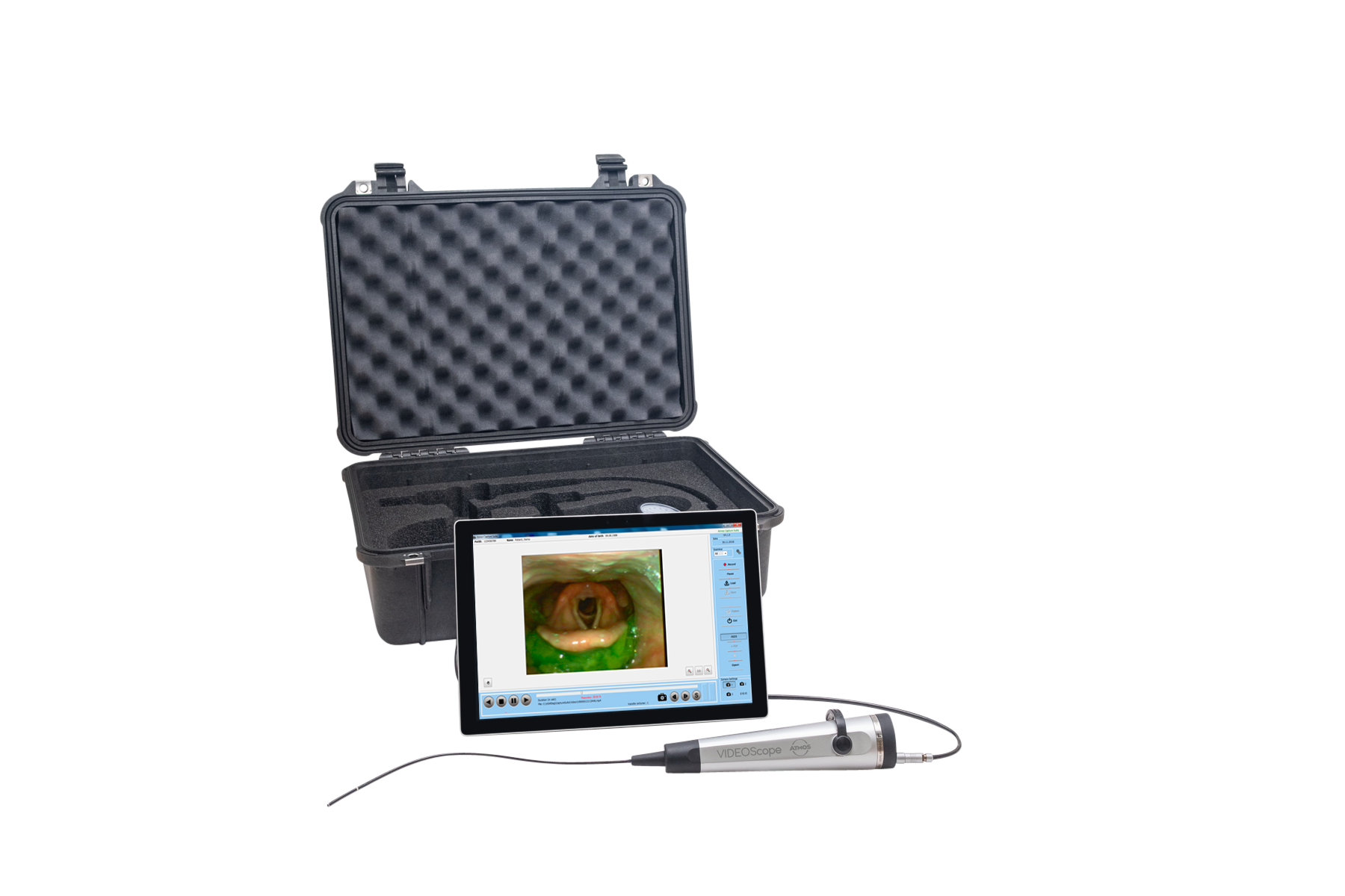 Ultra-Portable Distal Chip FEES | ATMOS FEES Fly - PED