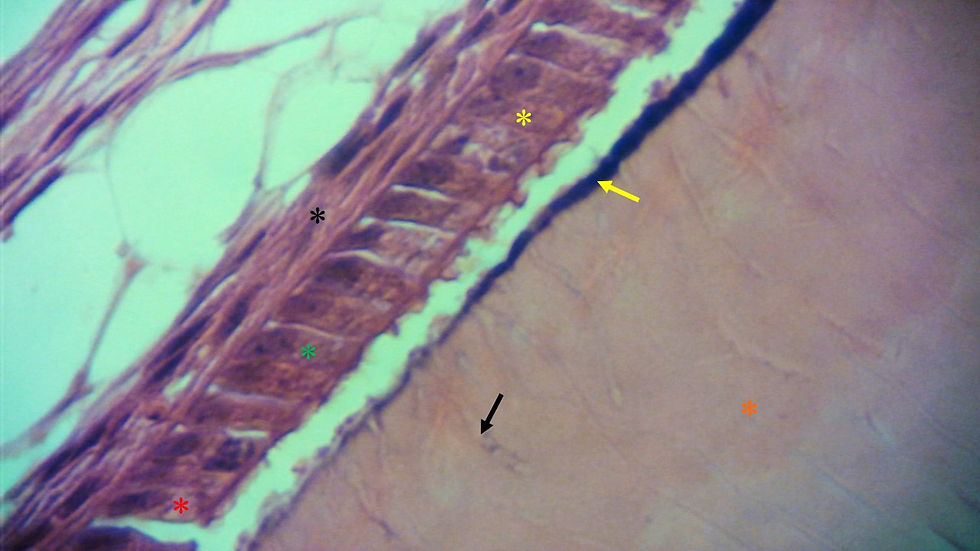 Amelogênese fases pré-secretora e secretora - primeira deposição do ...