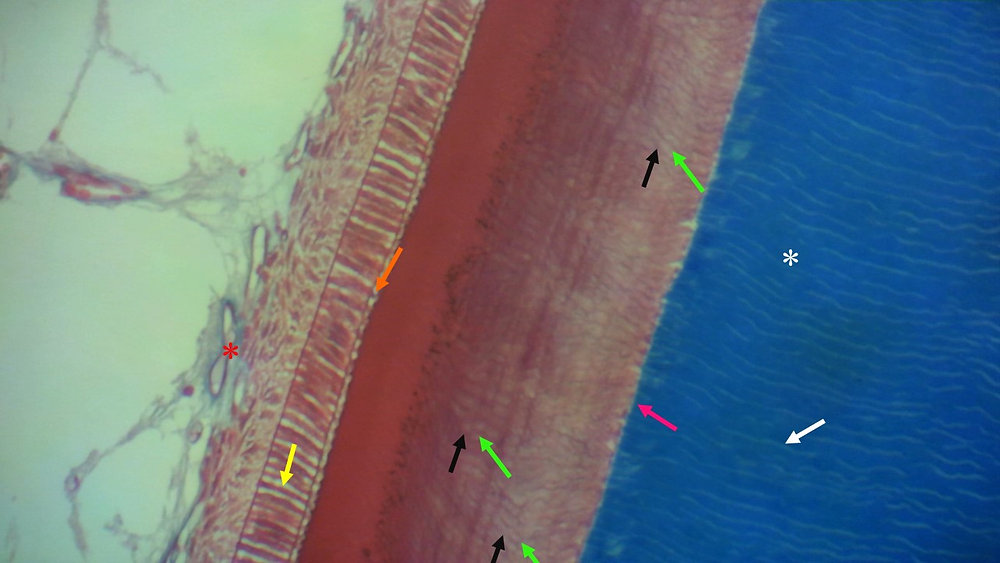 ESMALTE PRISMÁTICO (TRICÔMERO DE MASSON)