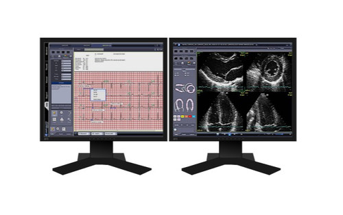 INFINITT Cardiology PACS | Thai GL Co., Ltd.