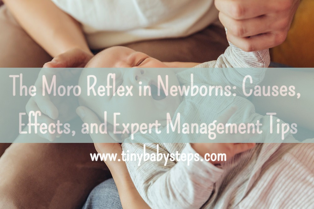 The Moro Reflex in Newborns: Causes, Effects, and Expert Management Tips