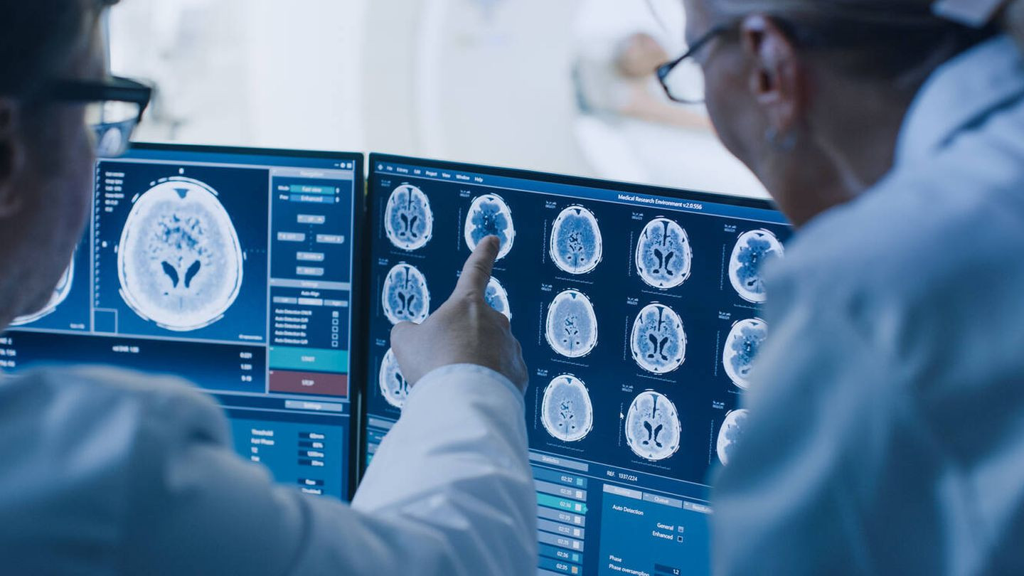 5 Maneras Sorprendentes en Que el Estrés Afecta tu Cerebro