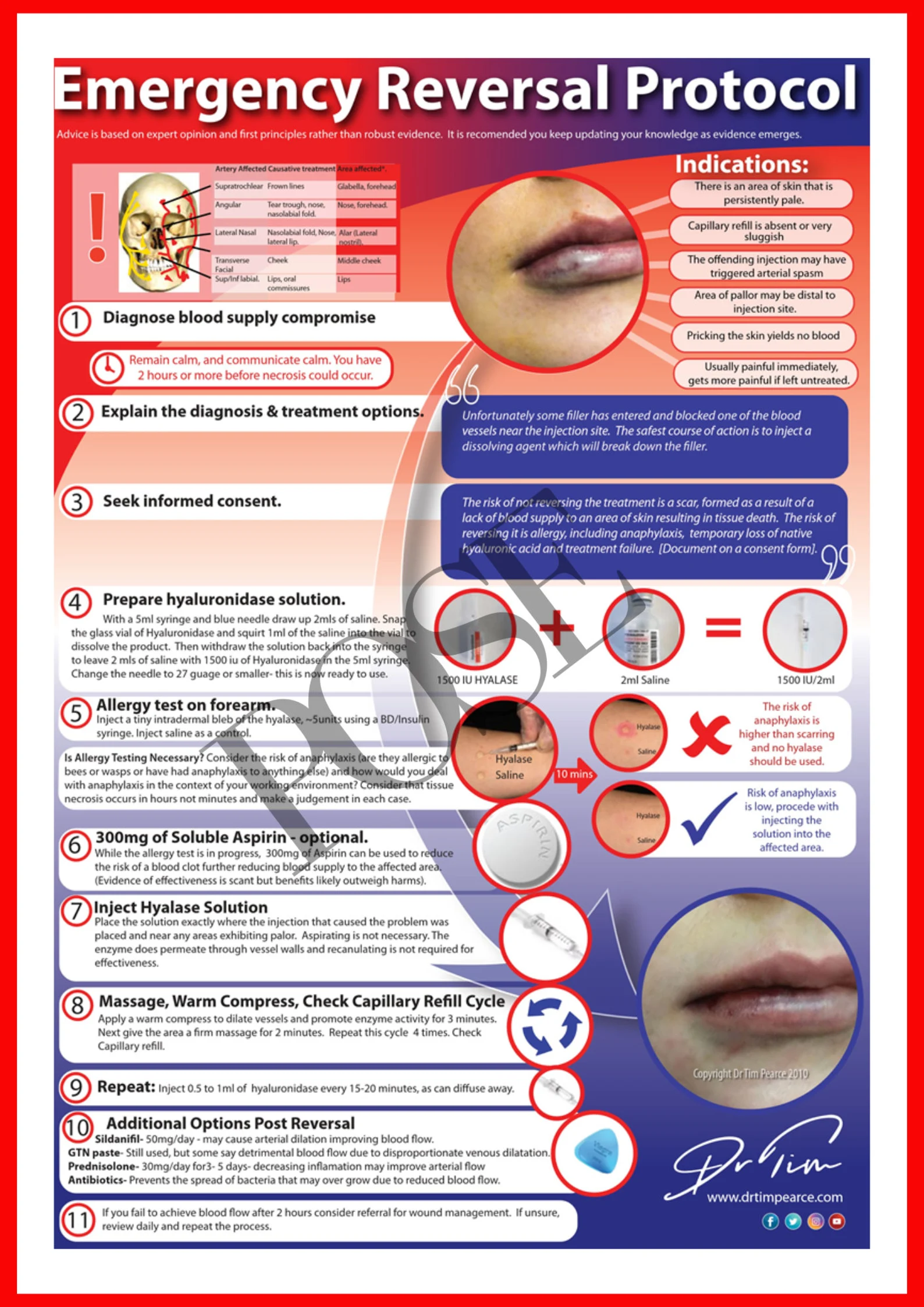 Foundation Filler and Botox Manual | Pose Aesthetics