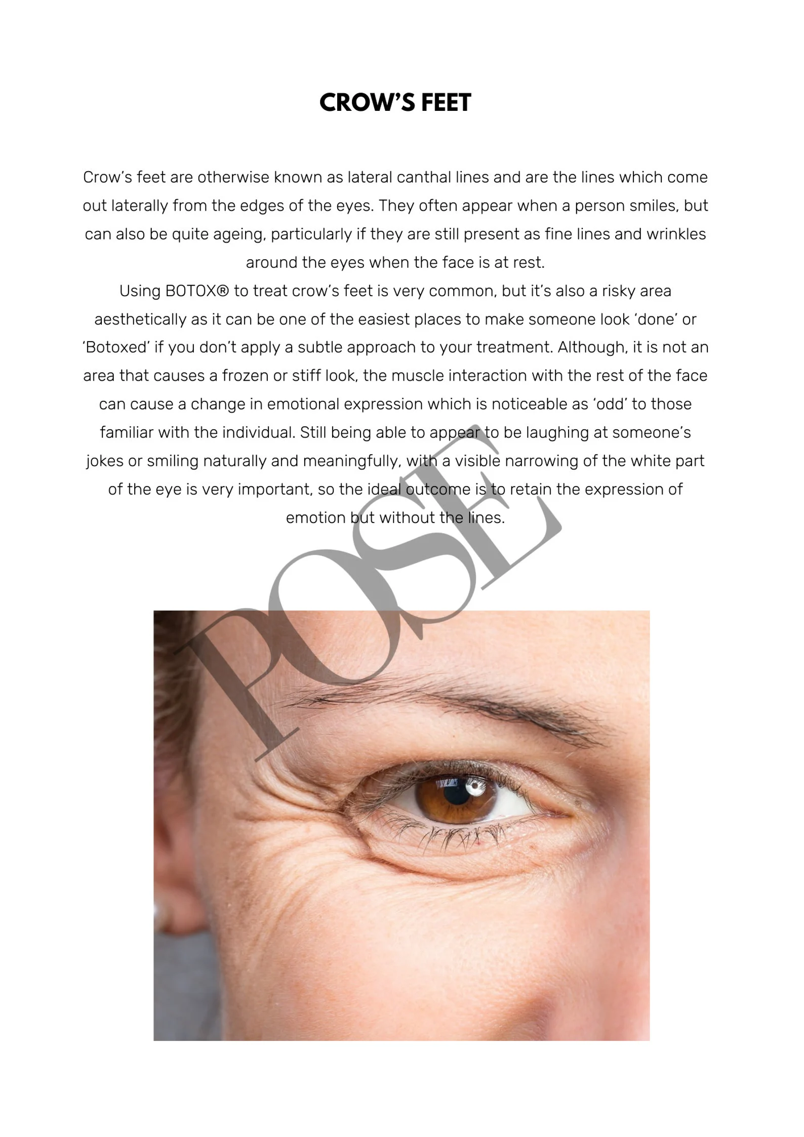 Foundation Filler and Botox Manual | Pose Aesthetics