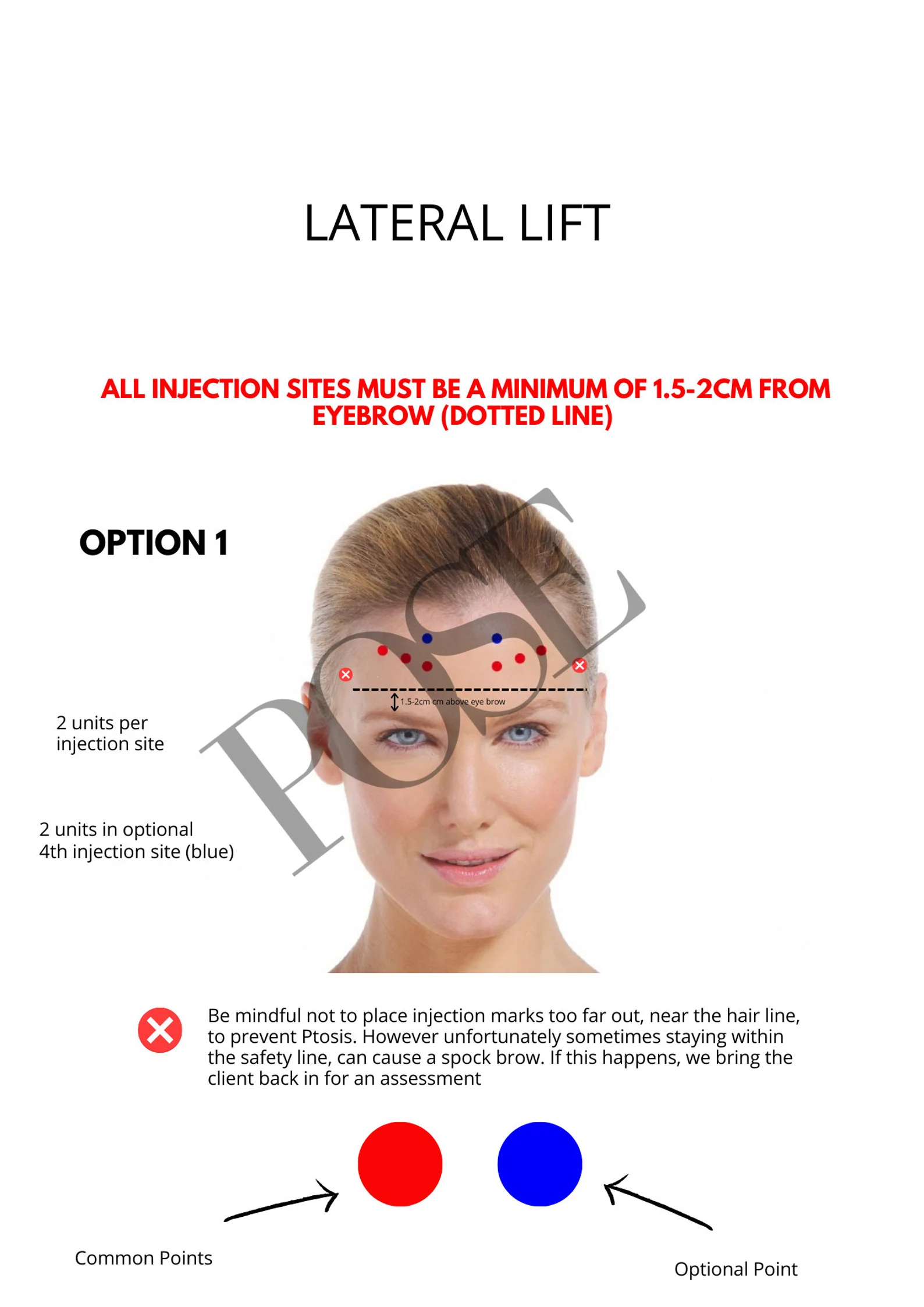 Foundation Filler and Botox Manual | Pose Aesthetics